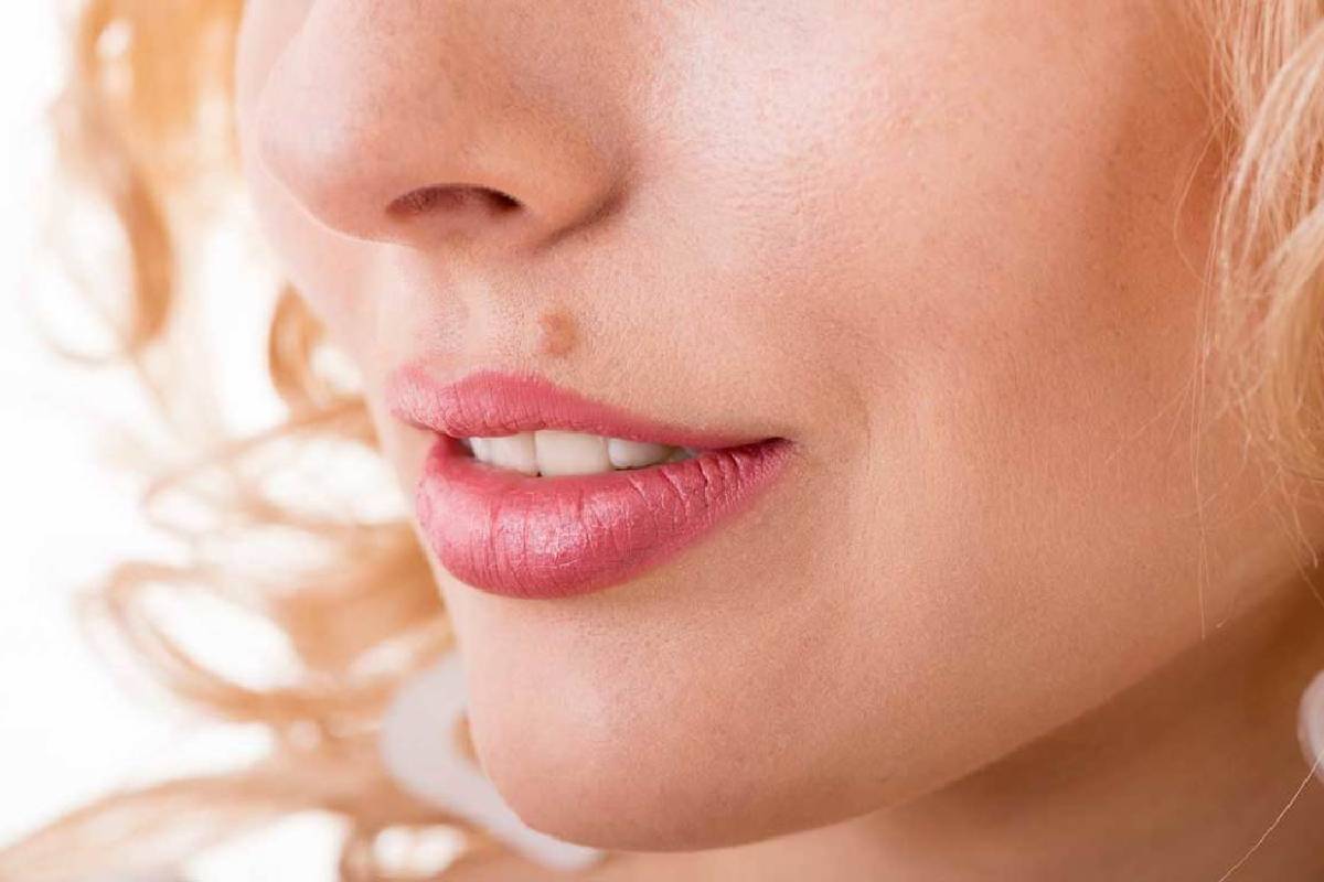 Can Beauty Marks Grow? – Description, Types and More - 2022